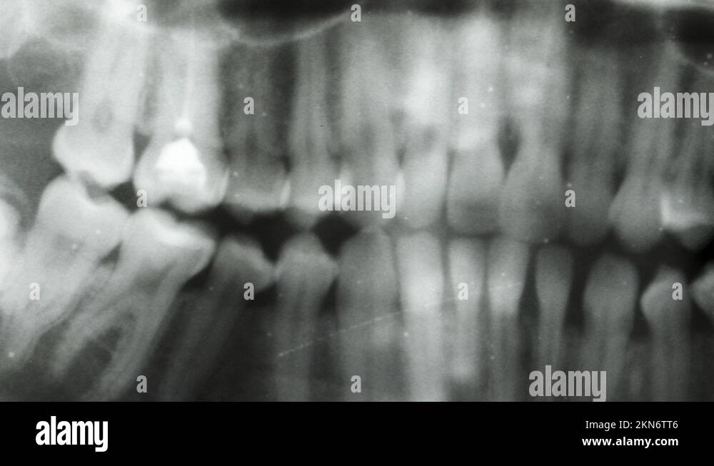 X ray horizontal Stock Videos & Footage - HD and 4K Video Clips - Alamy