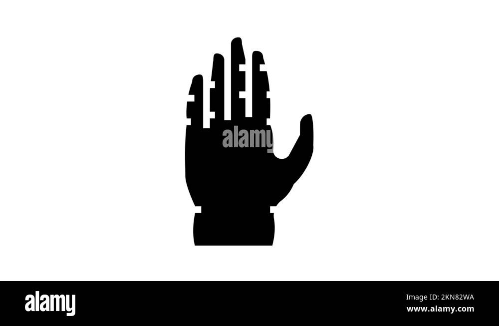 Edema arm Stock Videos & Footage - HD and 4K Video Clips - Alamy