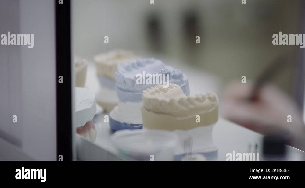 Jaw models in a dental laboratory. Manufacturing of dentures and ...