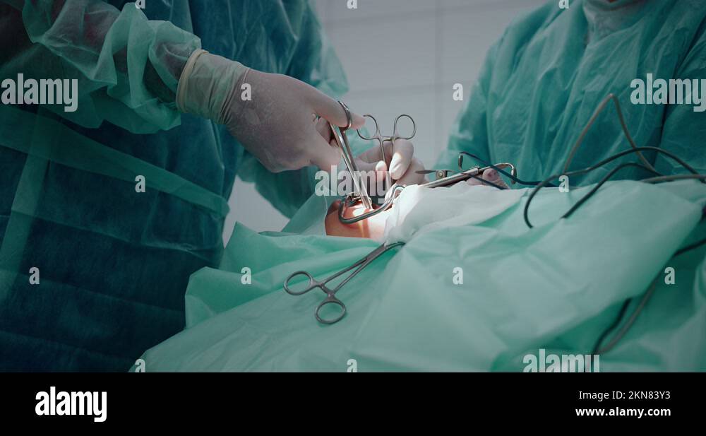 The doctor performs a pediatric surgical operation to remove the ...