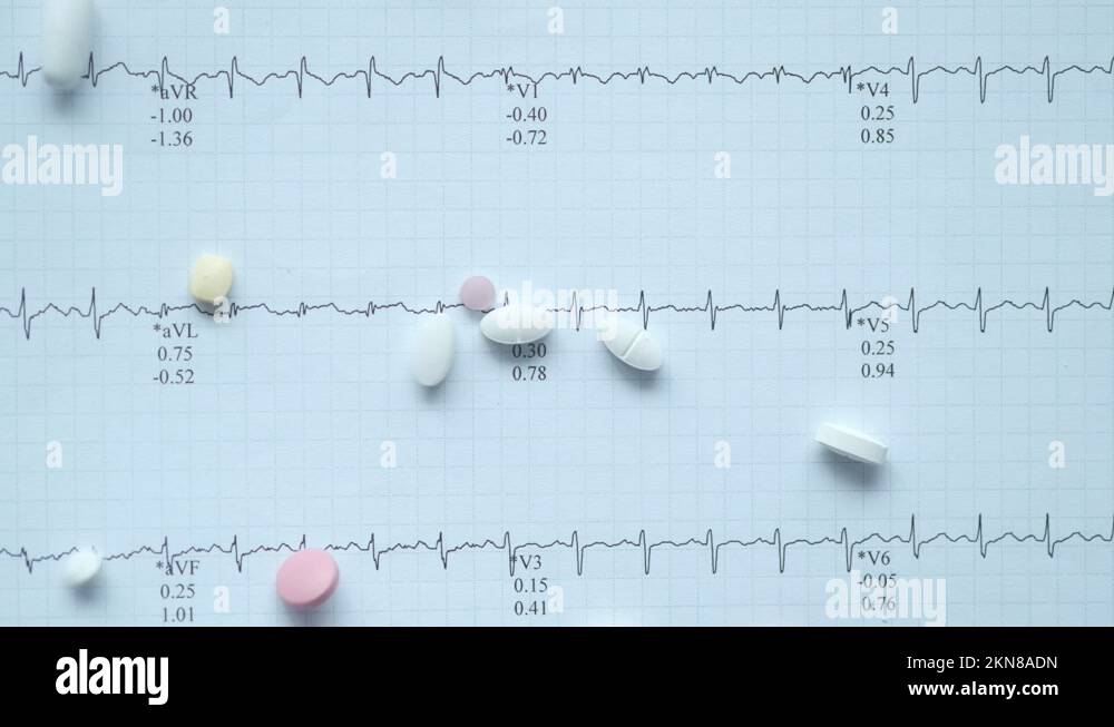 Cardiodiagram Stock Videos & Footage - HD and 4K Video Clips - Alamy