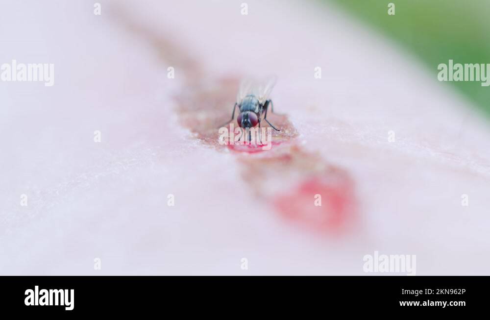 Wound scar Stock Videos & Footage - HD and 4K Video Clips - Alamy