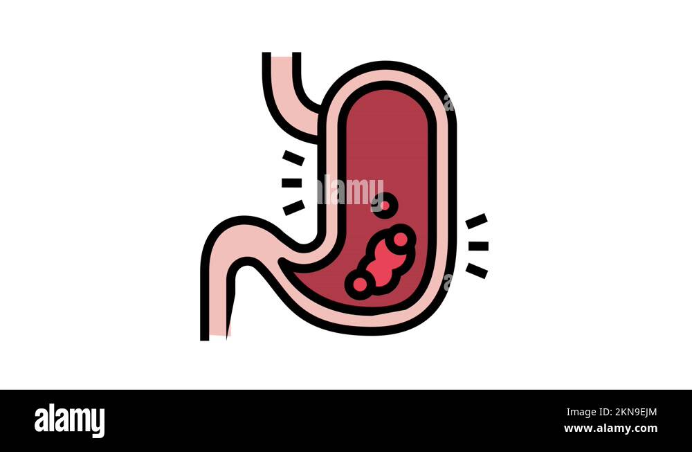 Gastric ulcers Stock Videos & Footage - HD and 4K Video Clips - Alamy