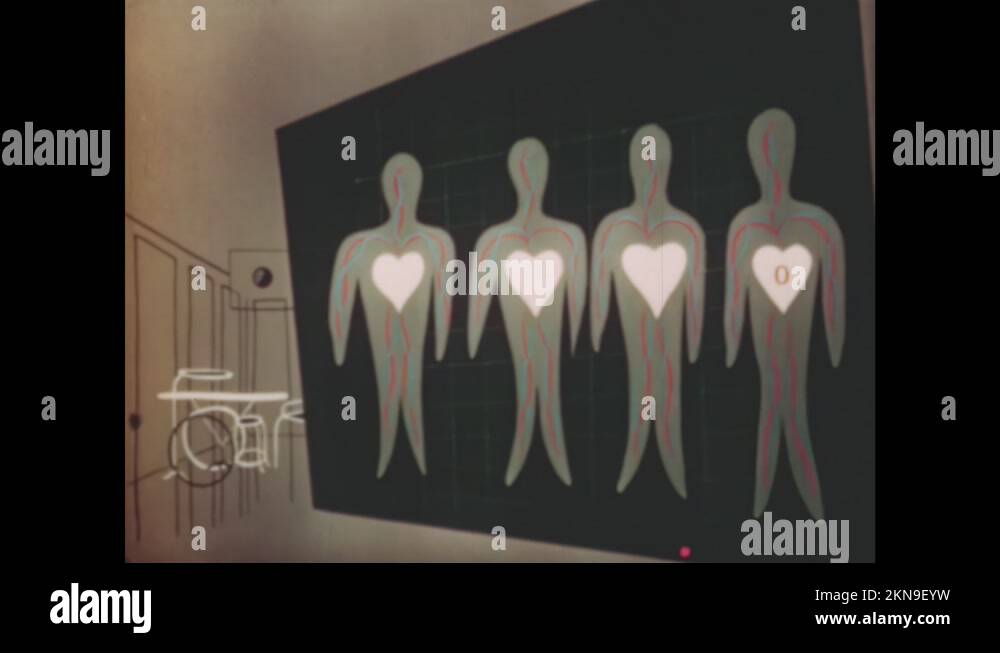 1940s: Cartoon. Blood types appear on hearts of figures. Patient in ...