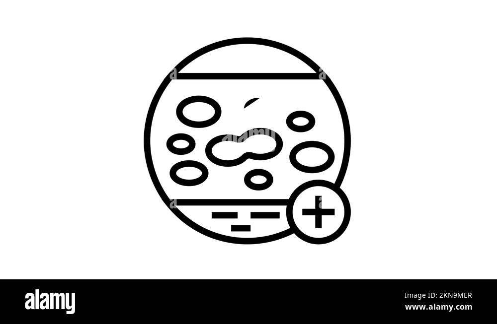 Autoimmune skin disease Stock Videos & Footage - HD and 4K Video Clips ...