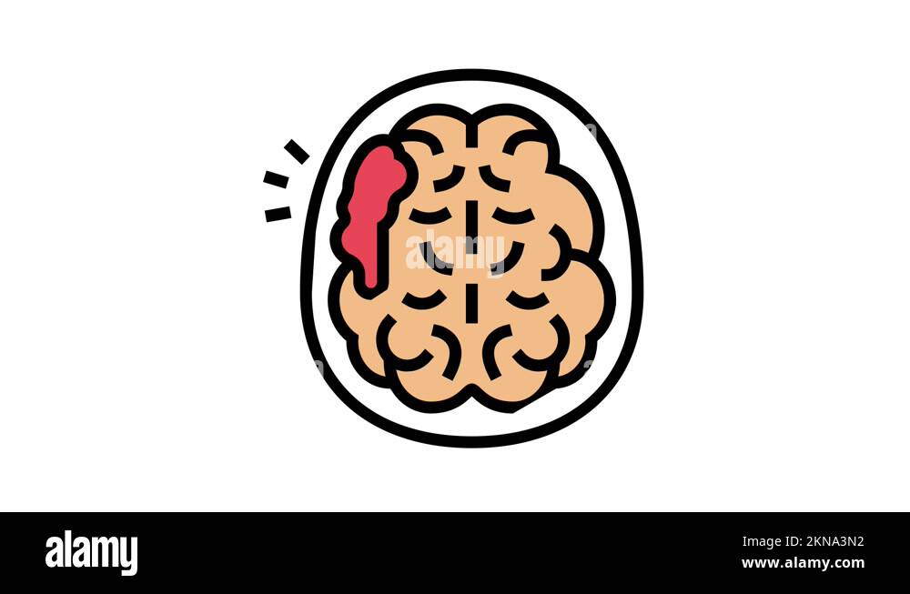 Brain injection Stock Videos & Footage - HD and 4K Video Clips - Alamy