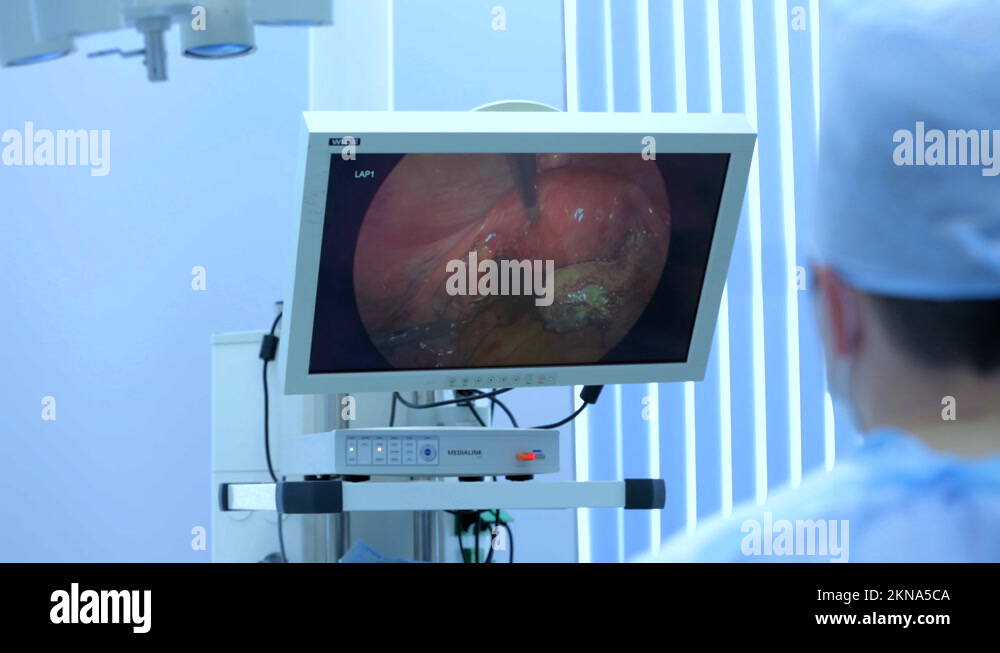 Real Time Surgeon Performs Tumor Removal Surgery. Organs. Laparoscopic ...