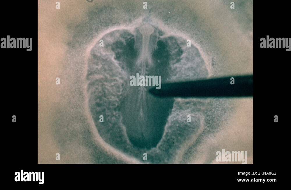 1960s: Chicken embryo. Pointer shows spinal cord Stock Video Footage ...