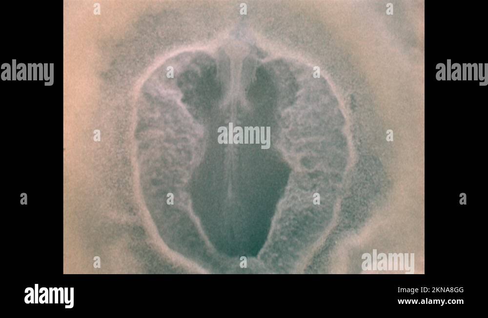 Bird embryo development Stock Videos & Footage - HD and 4K Video Clips ...