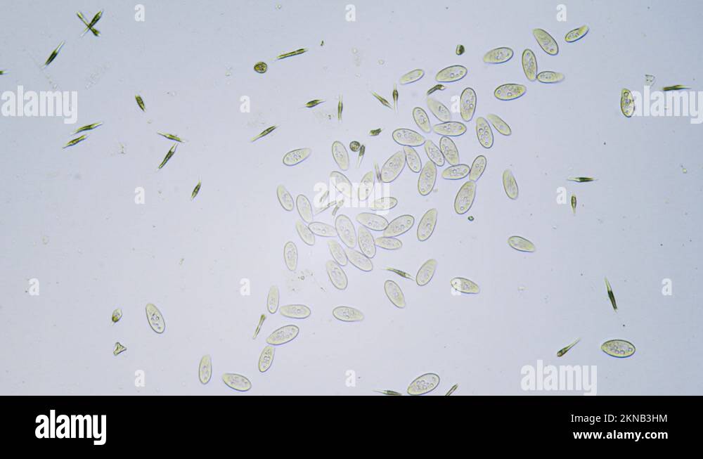 Protozoa single cell organisms in microscope bright field Stock Video ...