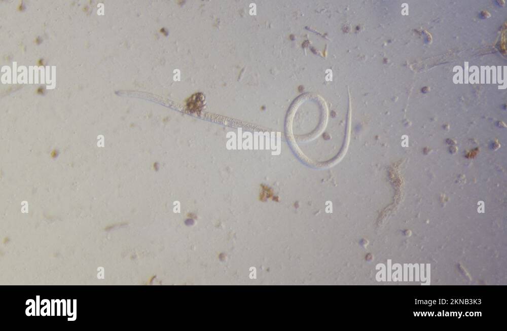 Nematode parasitic worm in microscope bright field Stock Video Footage ...