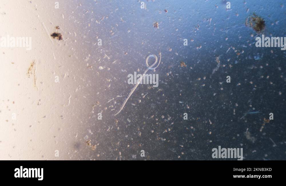 Nematode parasitic worm in microscope bright field Stock Video Footage ...
