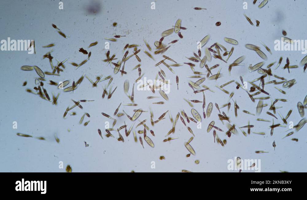 Protozoa single cell organisms in microscope bright field Stock Video ...