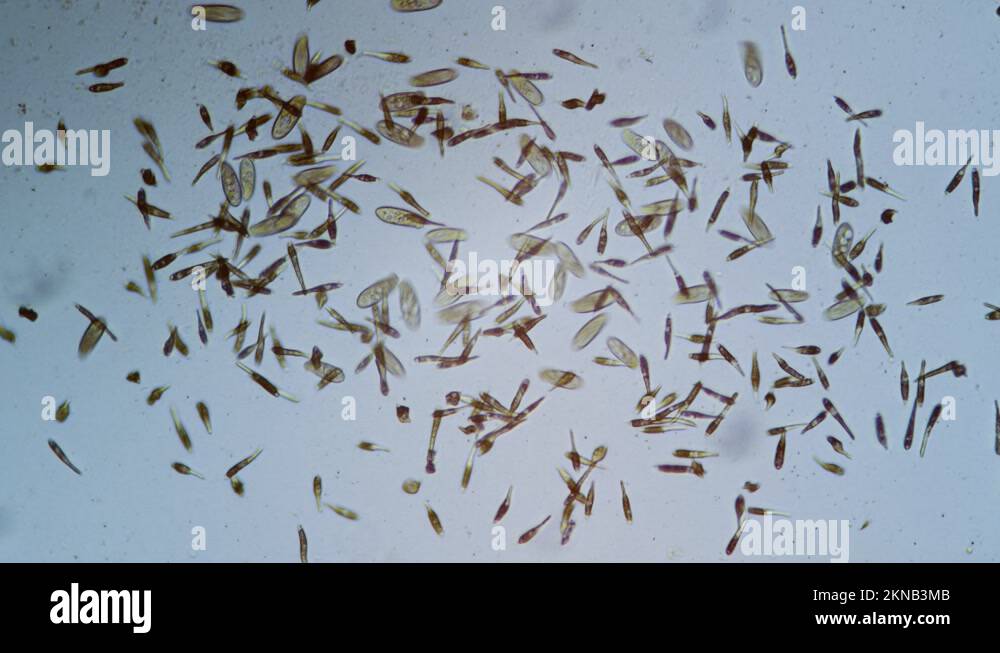 Protozoa single cell organisms in microscope bright field Stock Video ...