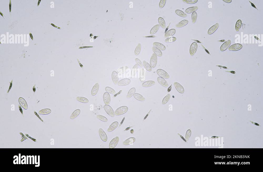 Protozoa single cell organisms in microscope bright field Stock Video ...