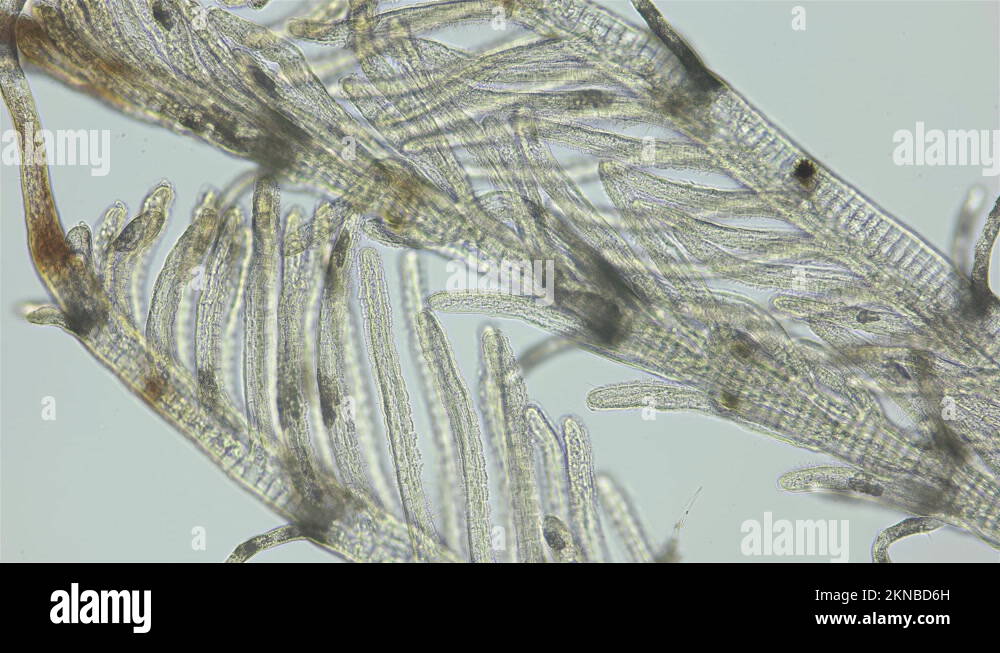 Polychaeta worm, family Sabellidae under a microscope. Video shows ...