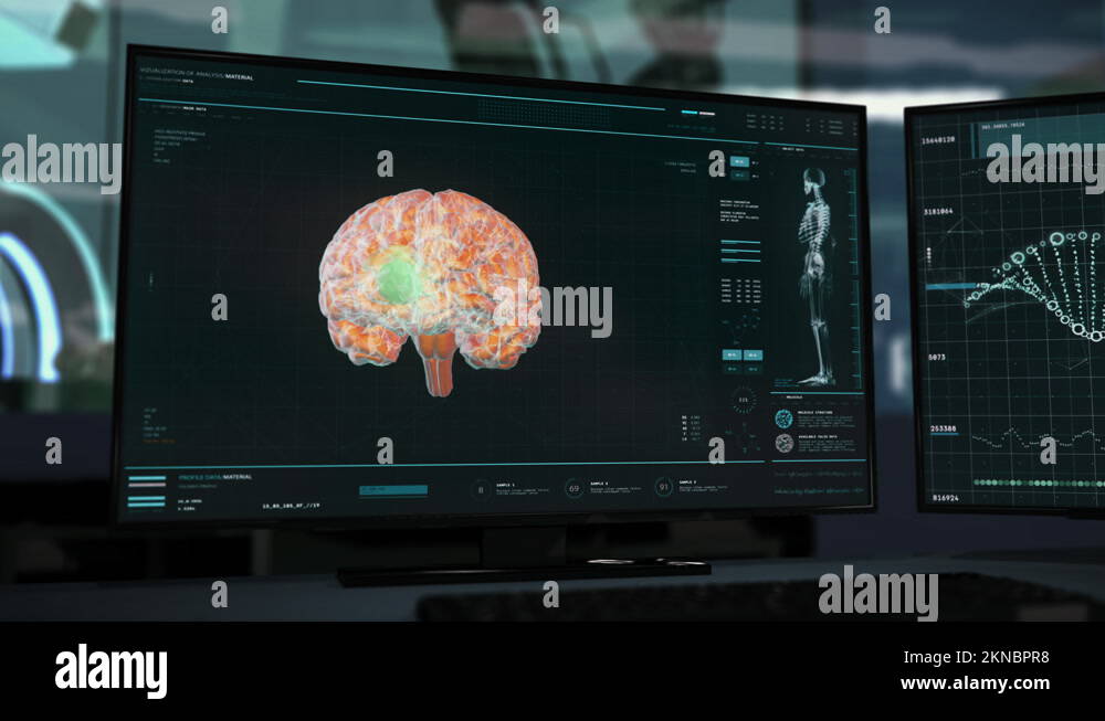 Human Brain Scan In Modern Medical Screening System For Health Care Research Stock Video Footage ...