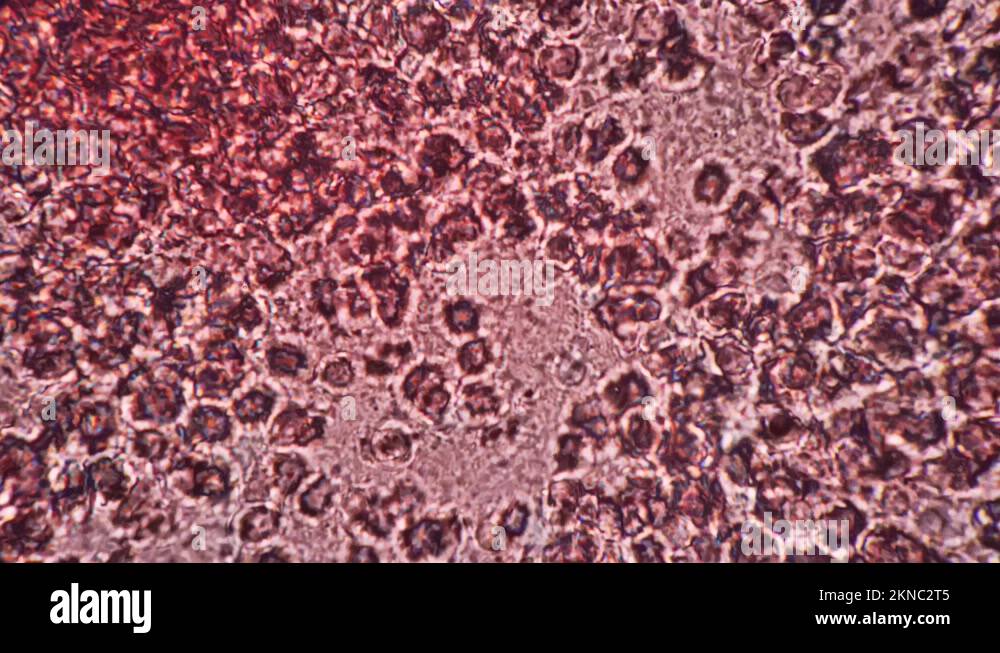 Magnified blood cells microscope Stock Videos & Footage - HD and 4K ...