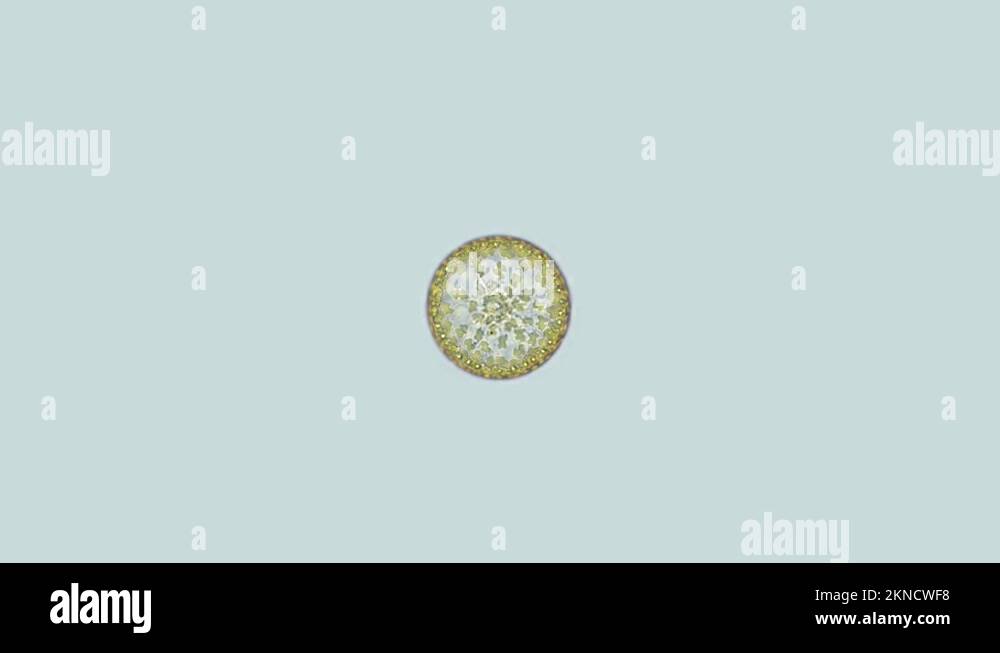 Diatom algae Family Stephanodiscaceae under the microscope, Ochrophyta ...