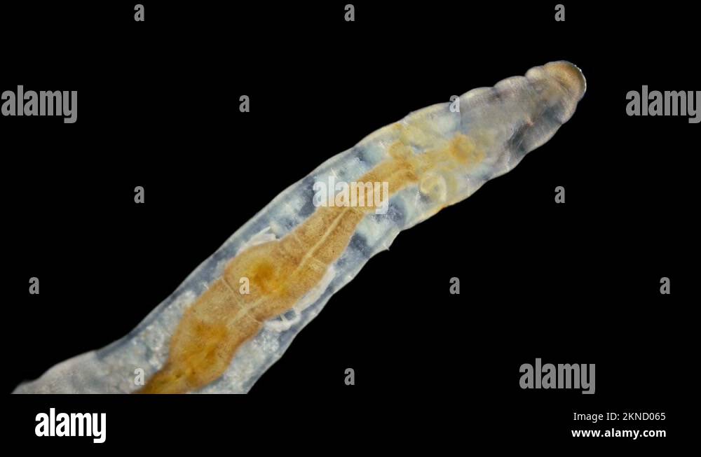 Oligochaeta worm under the microscope, class Clitellata, Phylum ...