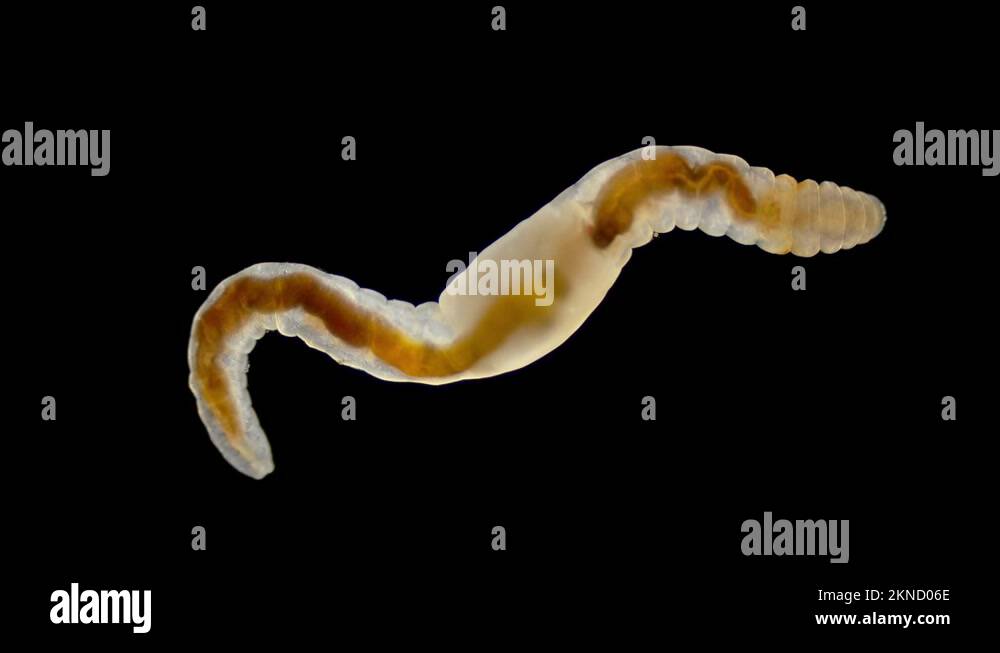Phylum annelida Stock Videos & Footage - HD and 4K Video Clips - Alamy