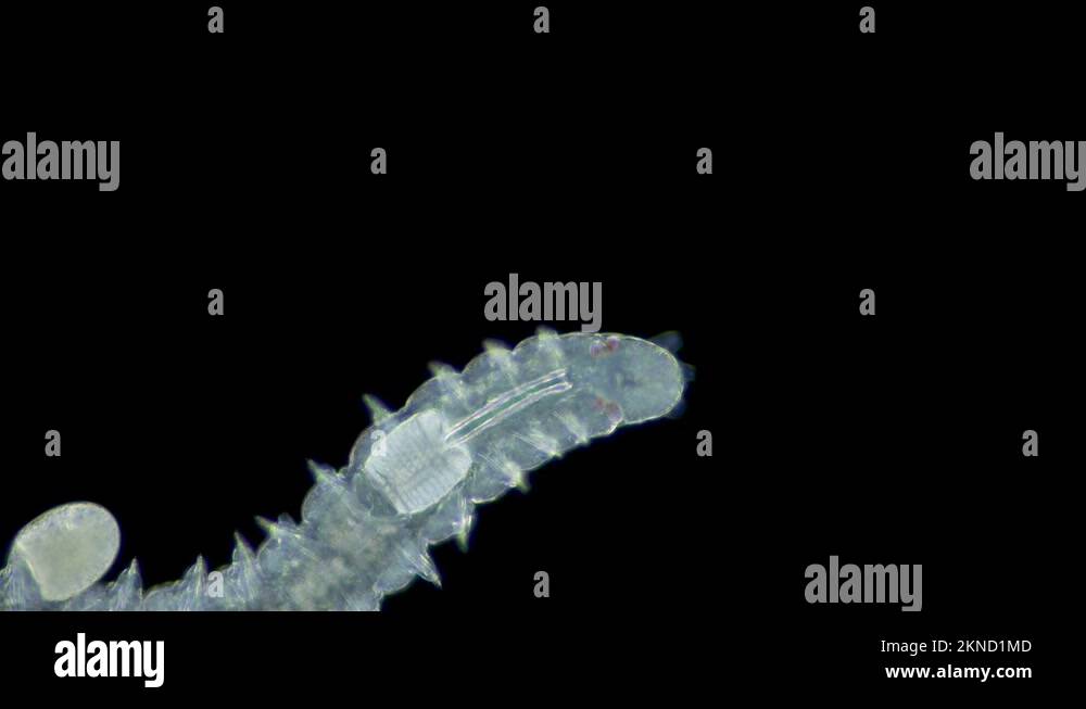 Worm family Syllidae under a microscope, Polychaeta class, Exogoninae ...