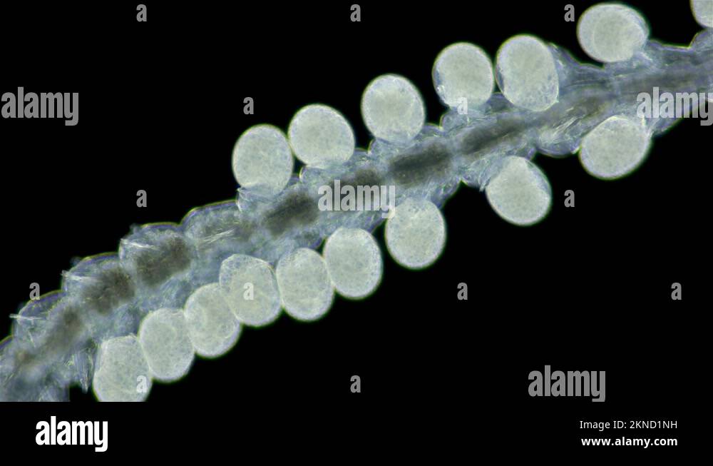 Worm family Syllidae under a microscope, Polychaeta class, Exogoninae ...