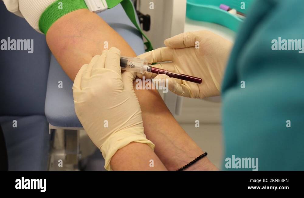 Complete skin analysis Stock Videos & Footage - HD and 4K Video Clips ...