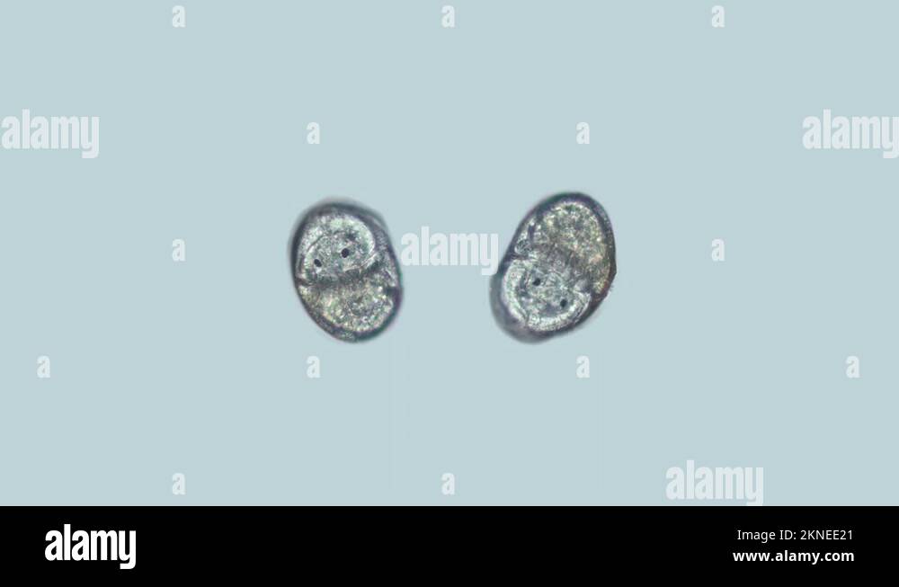 Larva of sea snail under microscope, called Veliger, class Bivalvia ...