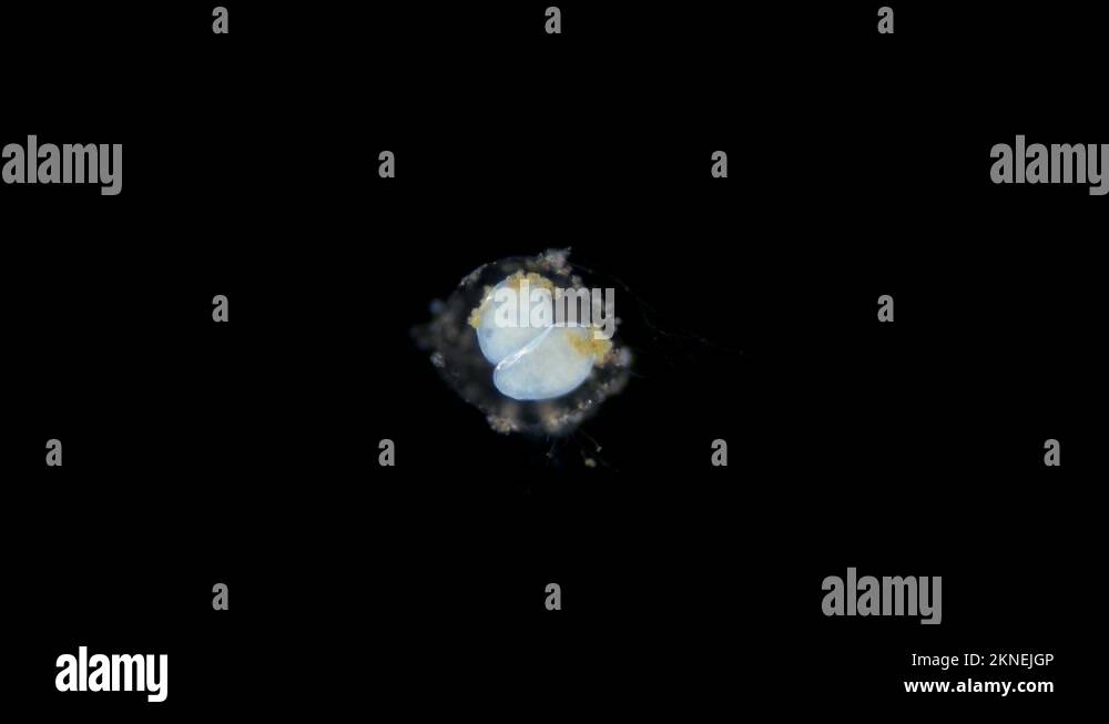 Two ciliates Ciliophora under the microscope, Alveolata Stock Video ...