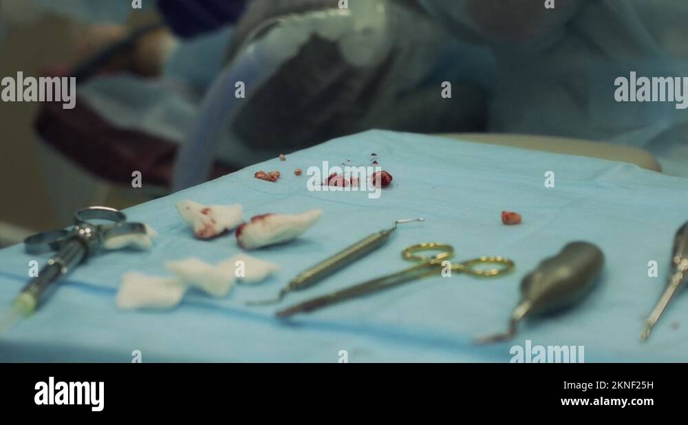 Surgical dental instruments on the table during tooth extraction ...