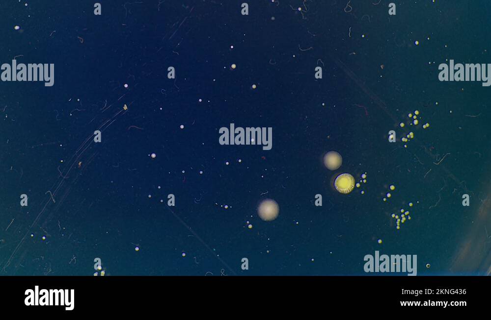Growth of colonies of microorganisms in a petri dish time lapse Stock ...