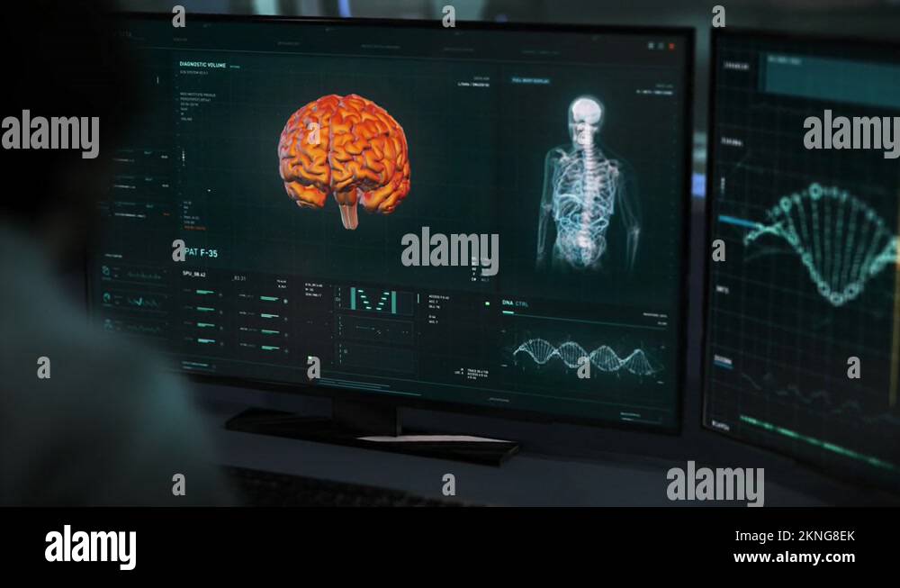 Futuristic Medical MRT Software For Diagnostic Of The Tumors Of A ...