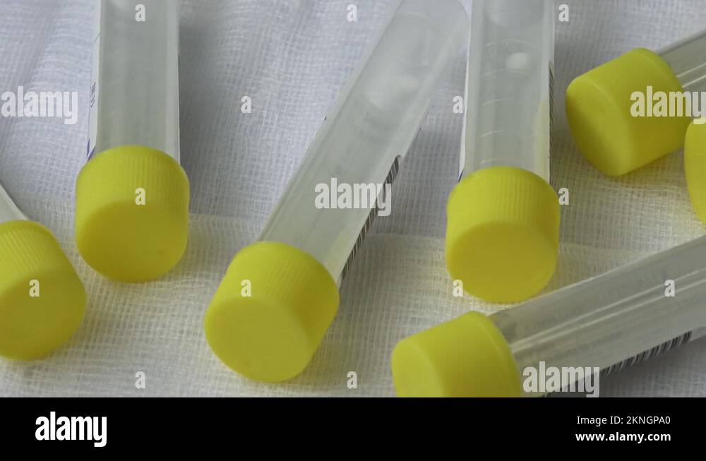 Medical sample tubes with Colorful Caps for different tests isolated ...
