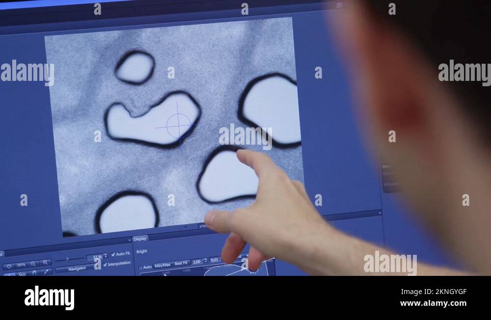 Microscope specimen Stock Videos & Footage - HD and 4K Video Clips - Alamy