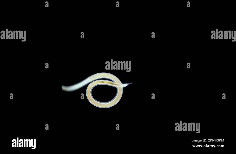 worm Nematoda under microscope, Phylum Protostomia, free-living nematodes Stock Video Footage ...
