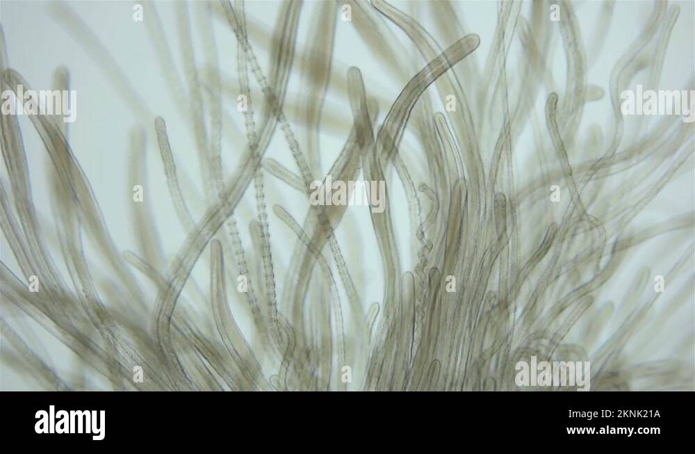 Worm Polychaeta of family Terebellidae under the microscope, phylum ...