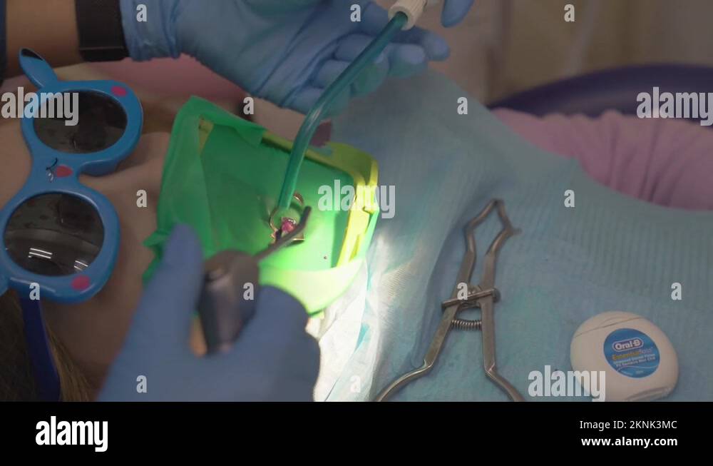 dentist uses Cofferdam for treatment caries and tooth reconstruction of ...
