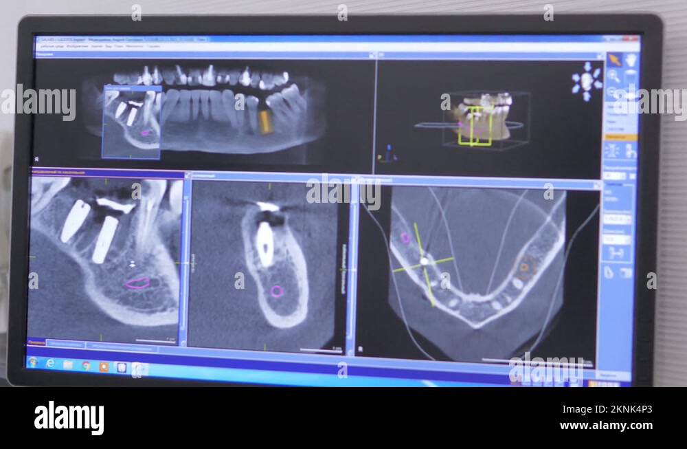 The dentist shows an X-ray of the jaw and teeth to the patient on the ...
