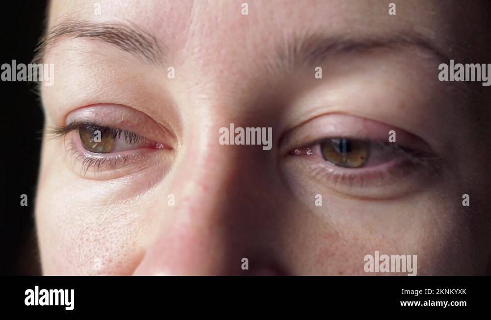 female eyes. closes and opens. without makeup, a little sleepy facial ...