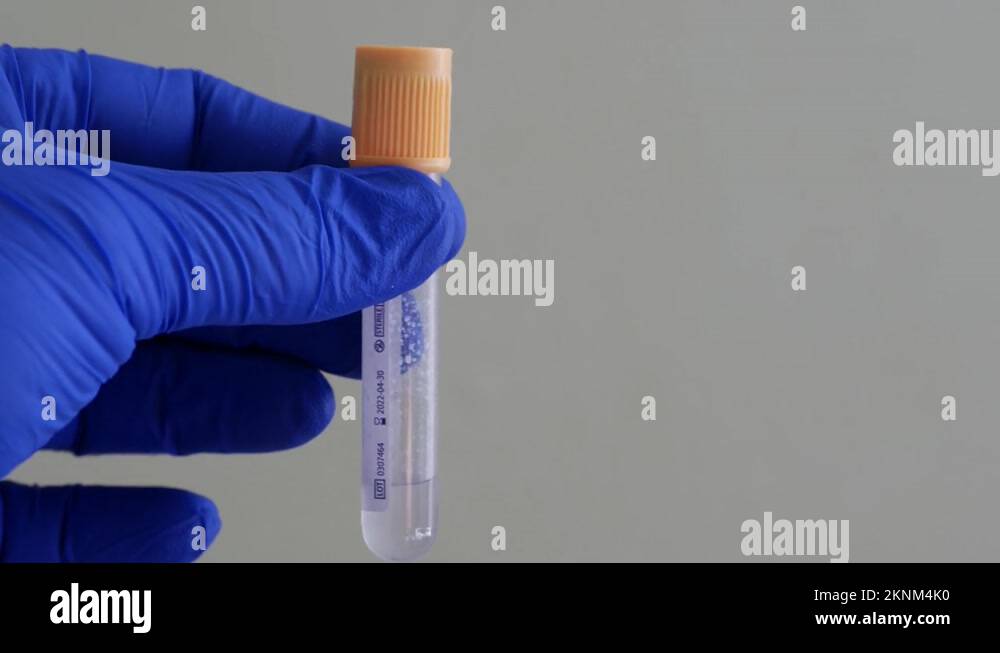 Blood collection container. Hand in blue nitrile glove. Empty blood ...