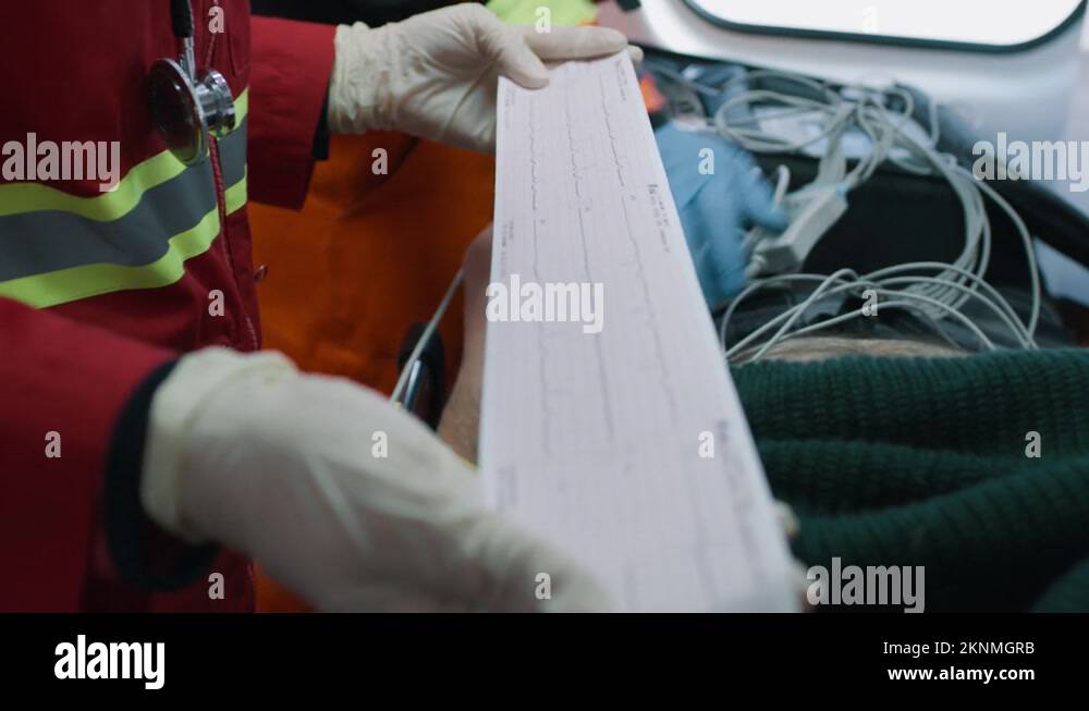 Ecg reading Stock Videos & Footage - HD and 4K Video Clips - Alamy