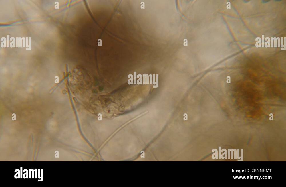 Nematode Worm Under Microscope, Parasites Among Roundworms: Roundworms ...