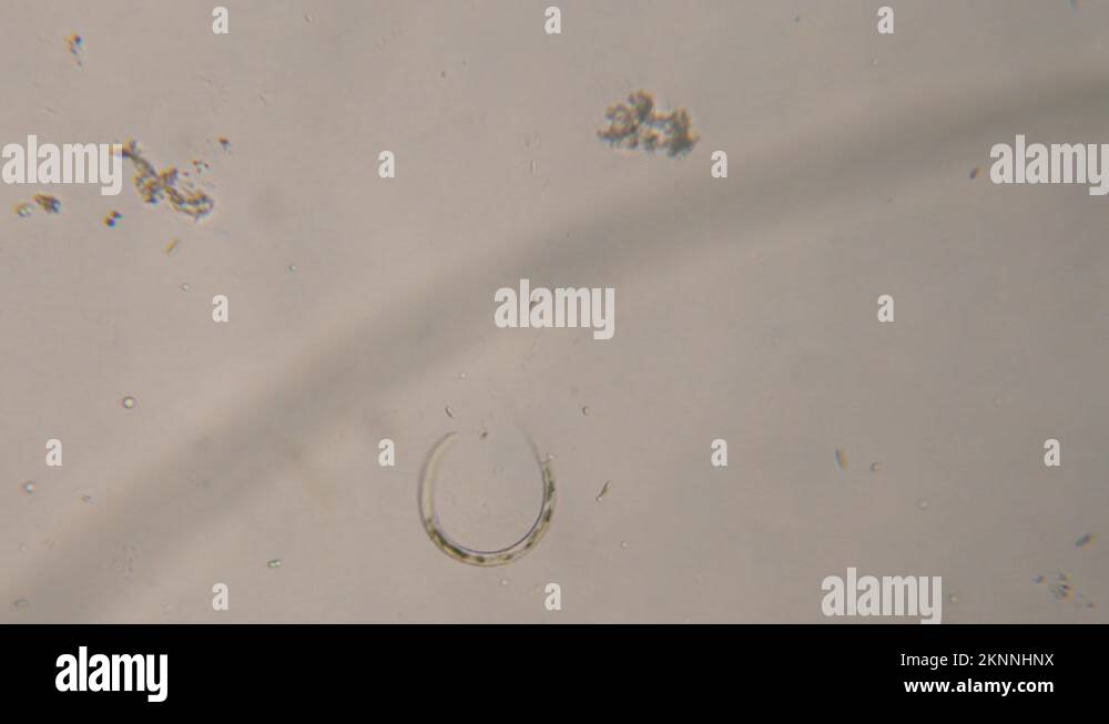 Nematode Worm Under Microscope, Parasites Among Roundworms: Roundworms ...