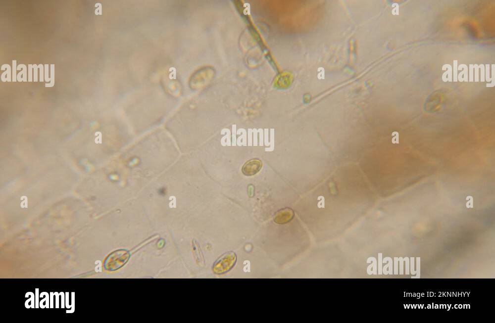 Death Of Plant Cell at Christy Keever blog