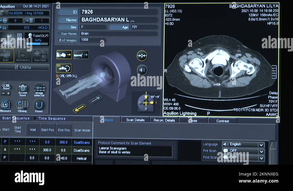 MRI scan screen animation. Computed medical tomography MRI Stock Video ...
