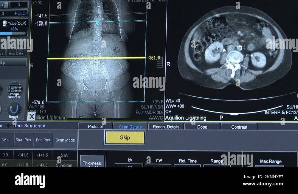 MRI scan screen animation. Computed medical tomography MRI Stock Video ...