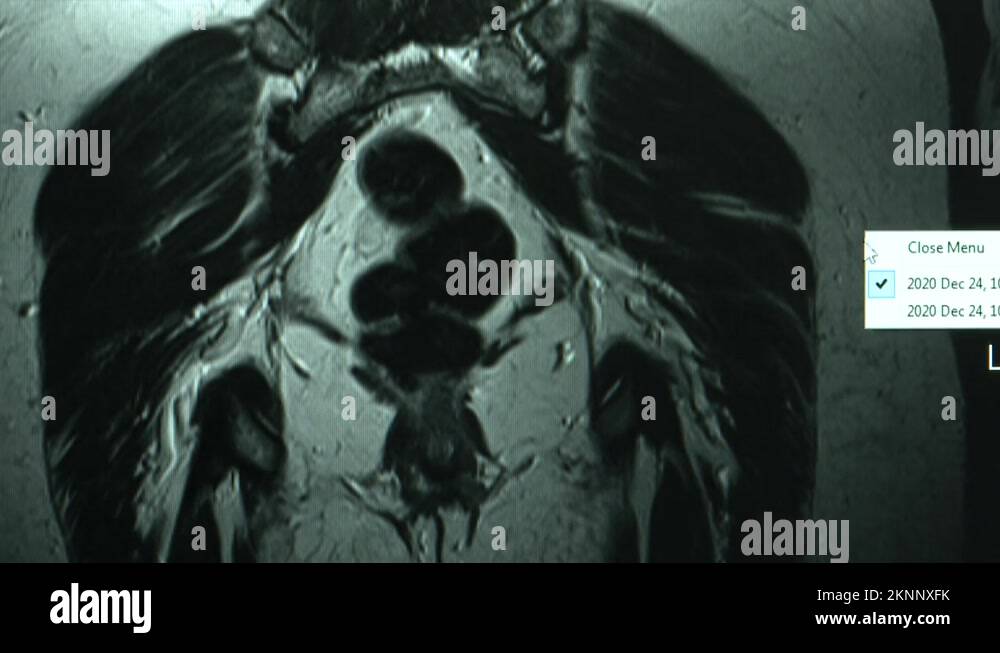 MRI scan screen animation. Computed medical tomography MRI Stock Video ...