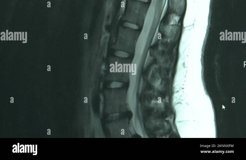 MRI scan screen animation. Computed medical tomography MRI Stock Video ...