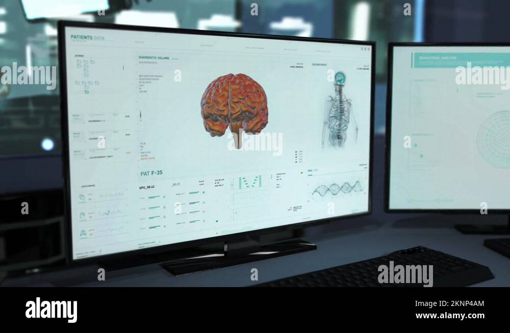 Anatomical Examination By Medical Hospital Diagnostic Scanner Equipment ...
